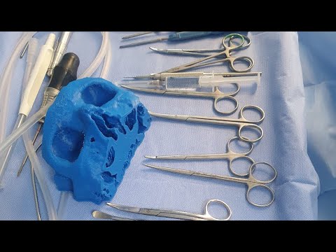 Orbital floor reconstruction with titanium mesh. Subciliary approach ...