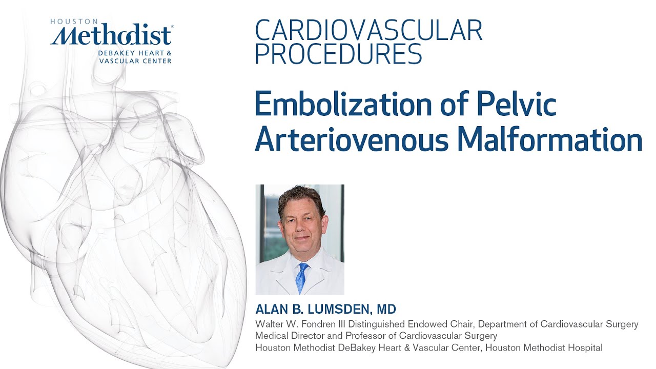 Embolization of Pelvic Arteriovenous Malformation (Alan B. Lumsden, MD ...