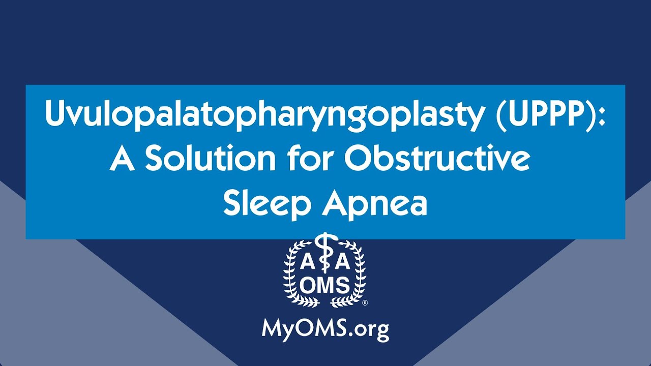 Uvulopalatopharyngoplasty UPPP A Solution for Obstructive Sleep Apnea ...