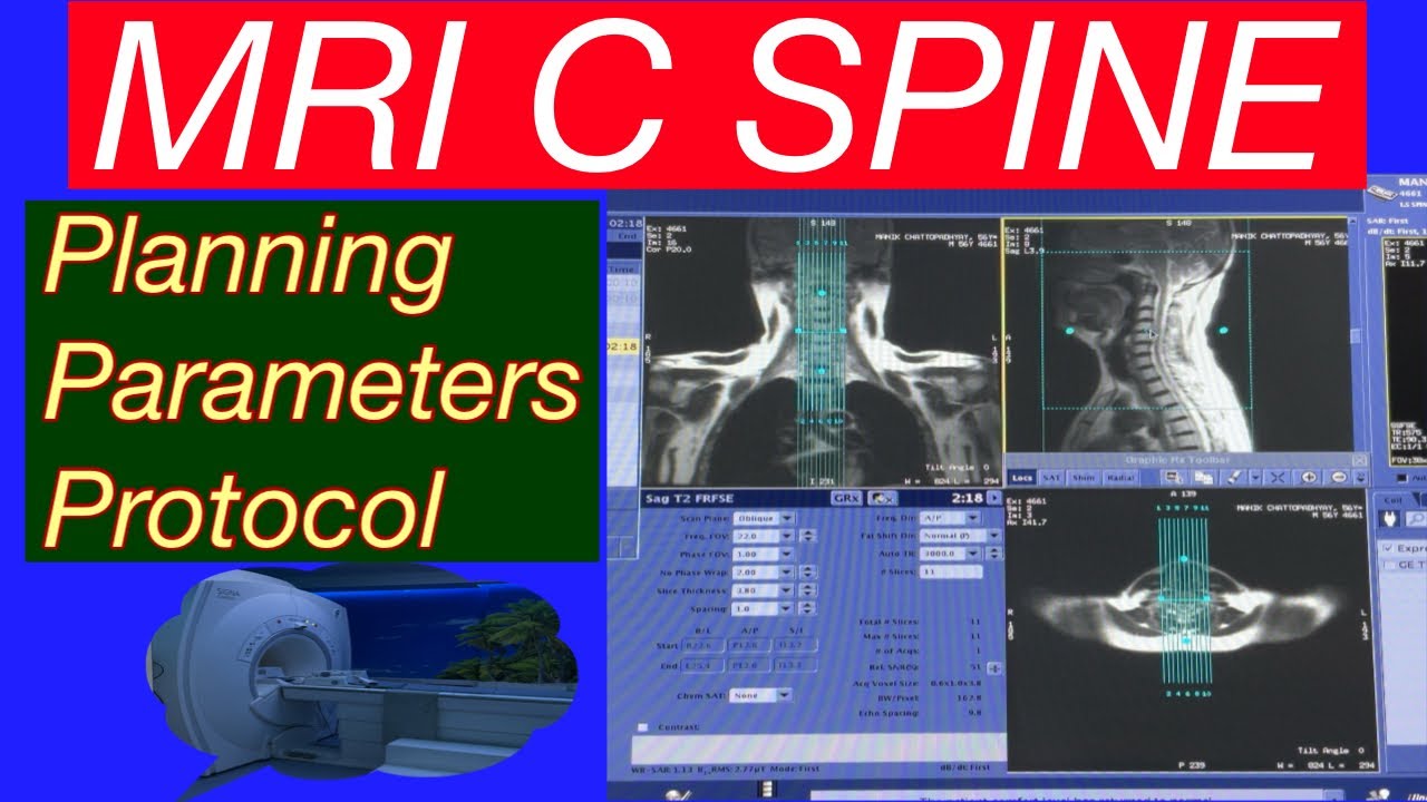 MRI C SPINE PLANNING step by step #Mri c spine protocol or scanning ...