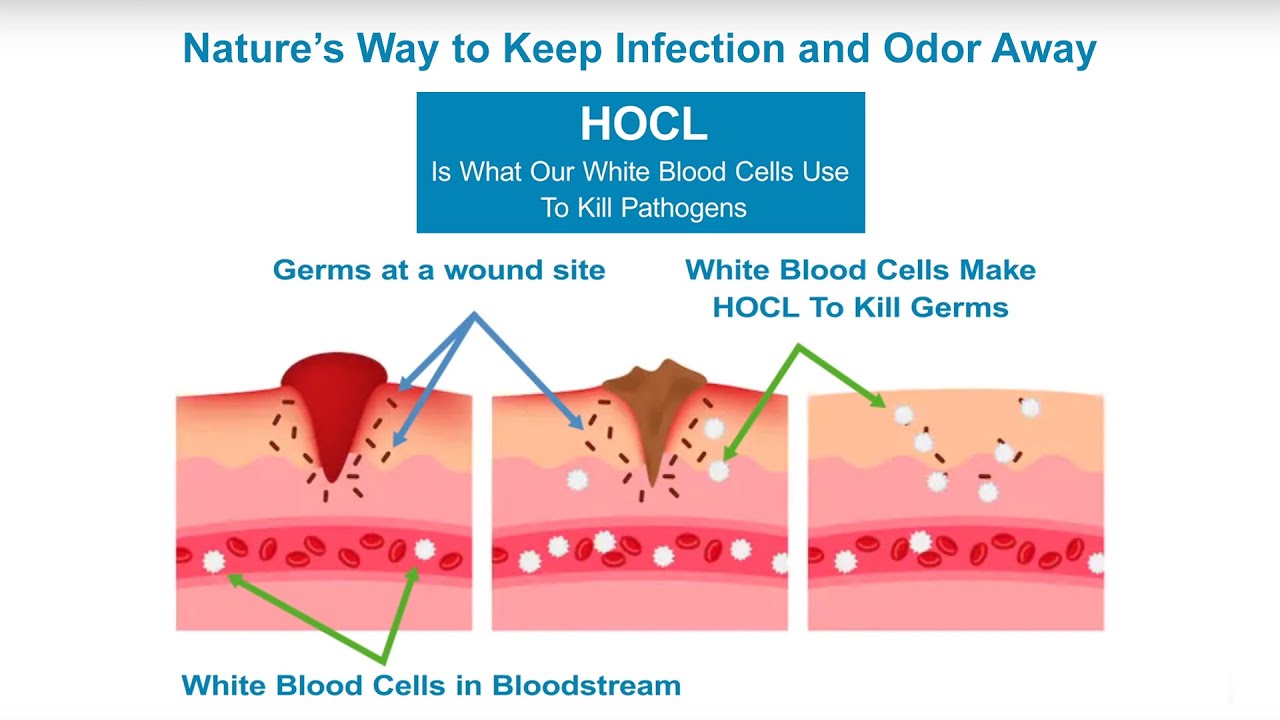 HOCL - Nature's way to infection and odor away. - YouTube