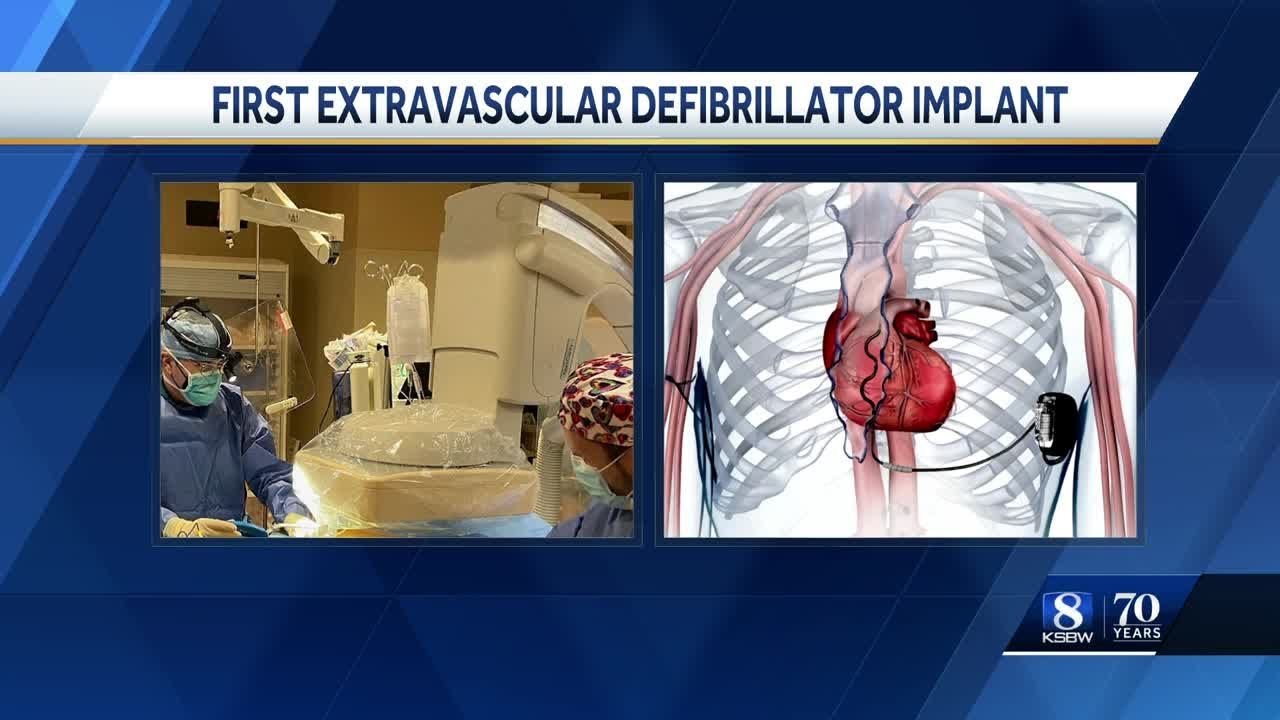 Dignity Health hospital first in the west to implant extravascular ...