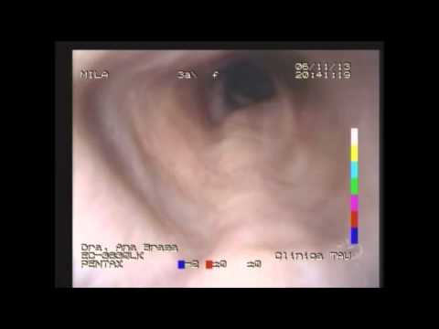 esofagoscopia veterinária - YouTube