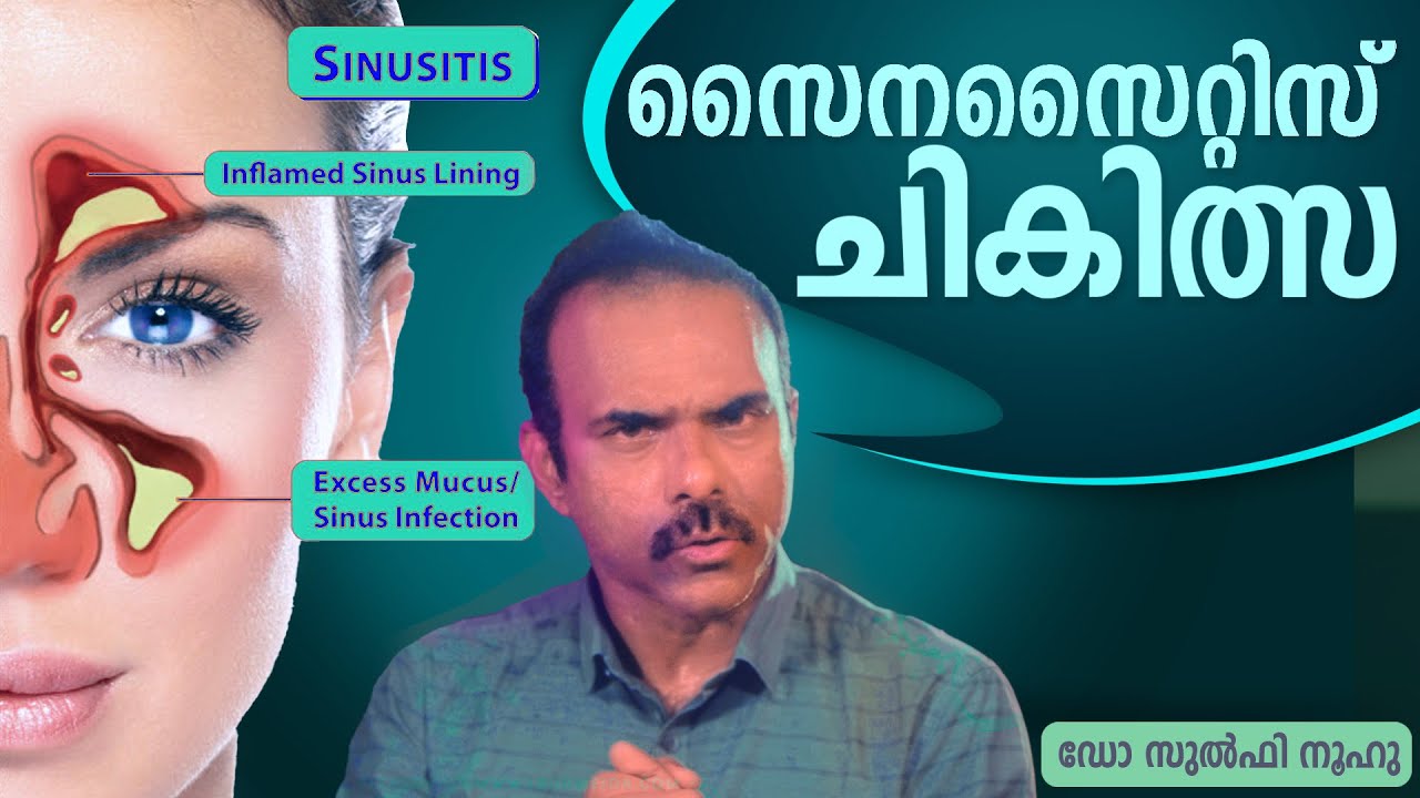 സൈനസൈറ്റിസ് ചികിത്സ അറിയേണ്ടതെല്ലാം | ഡോ സുല്‍ഫി നൂഹു | Dr Sulphi Noohu ...
