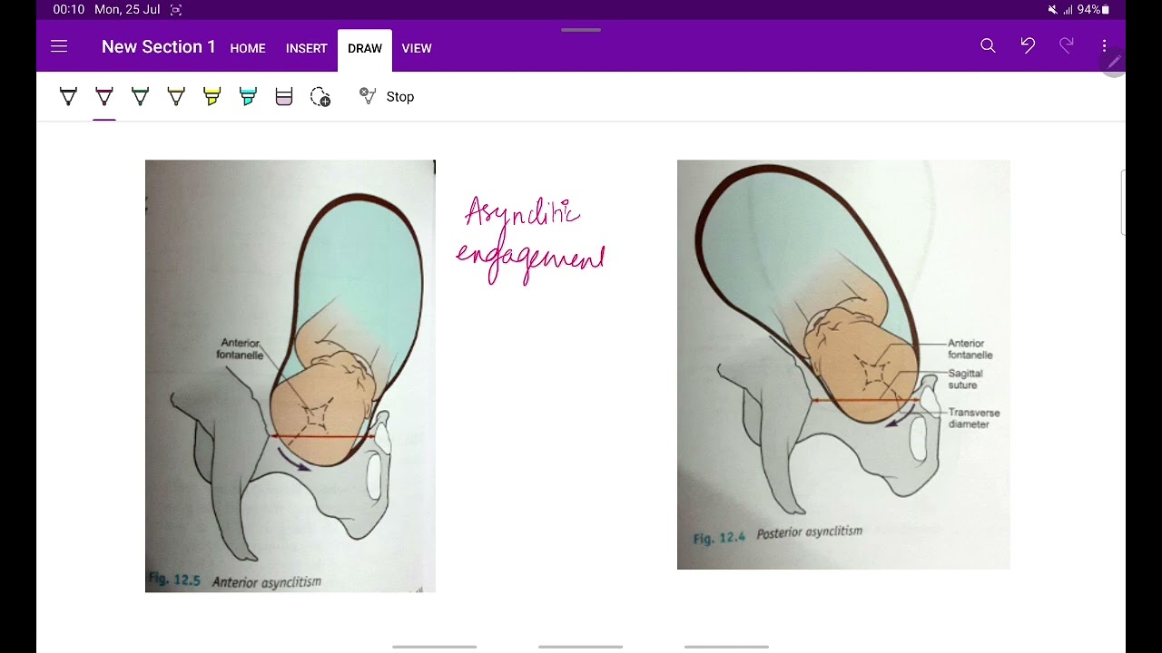 Cardinal movements of labor flexion - horizonrolf