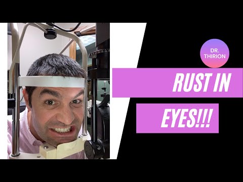 Rust in Eye Removed - YouTube