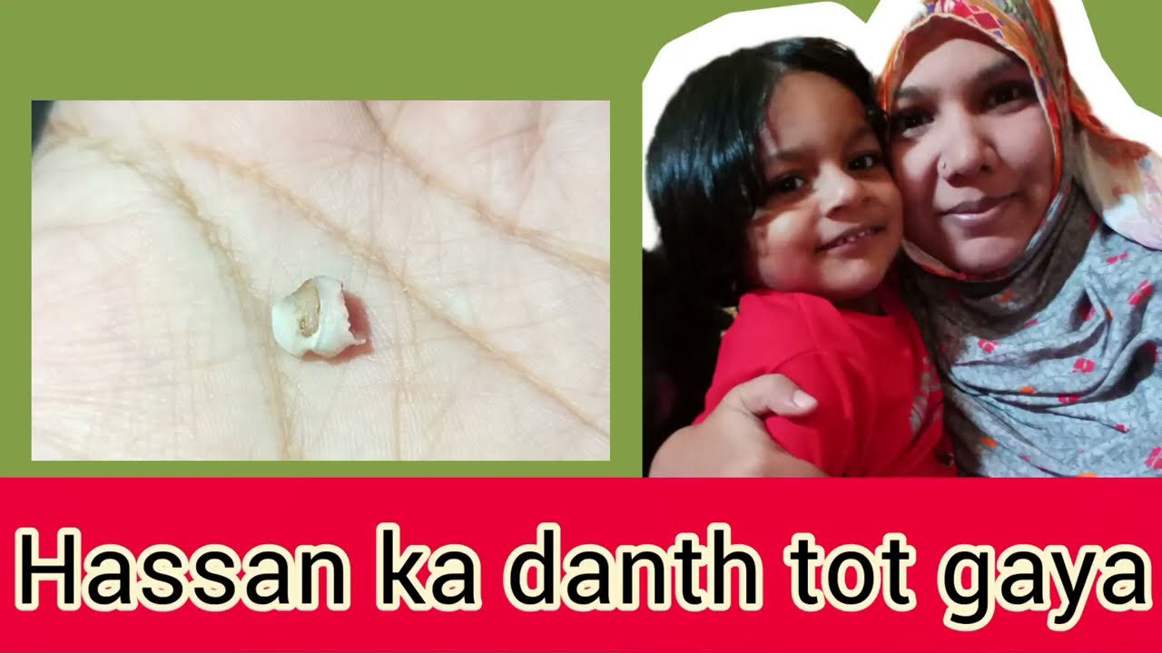 Hassan ka danth toot gaya, baby shark dooo dooo - YouTube