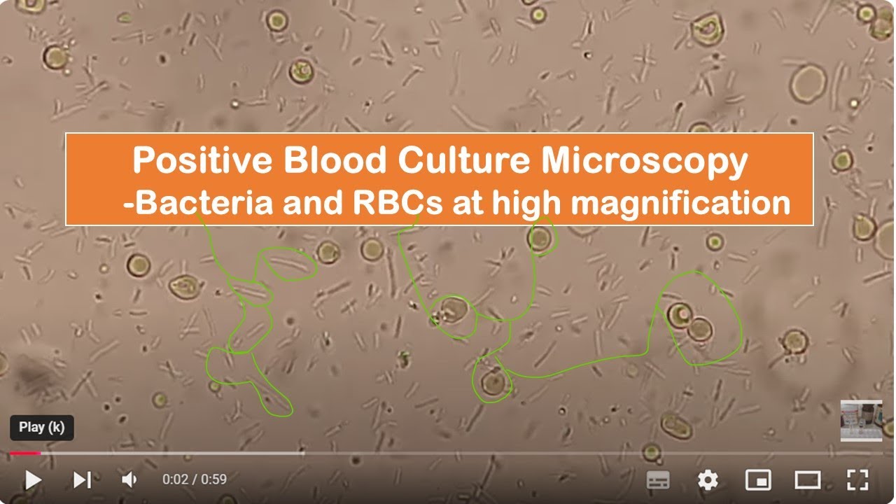 Close-Up View: Bacteria and Red Blood Cells Under High Magnification ...