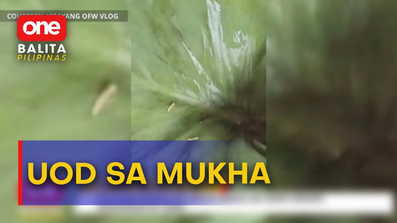 Paglabas umano ng uod sa mukha ng isang ginang, nakuhanan sa video ...