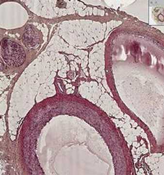 Shotgun Histology Neurovascular Bundle - YouTube