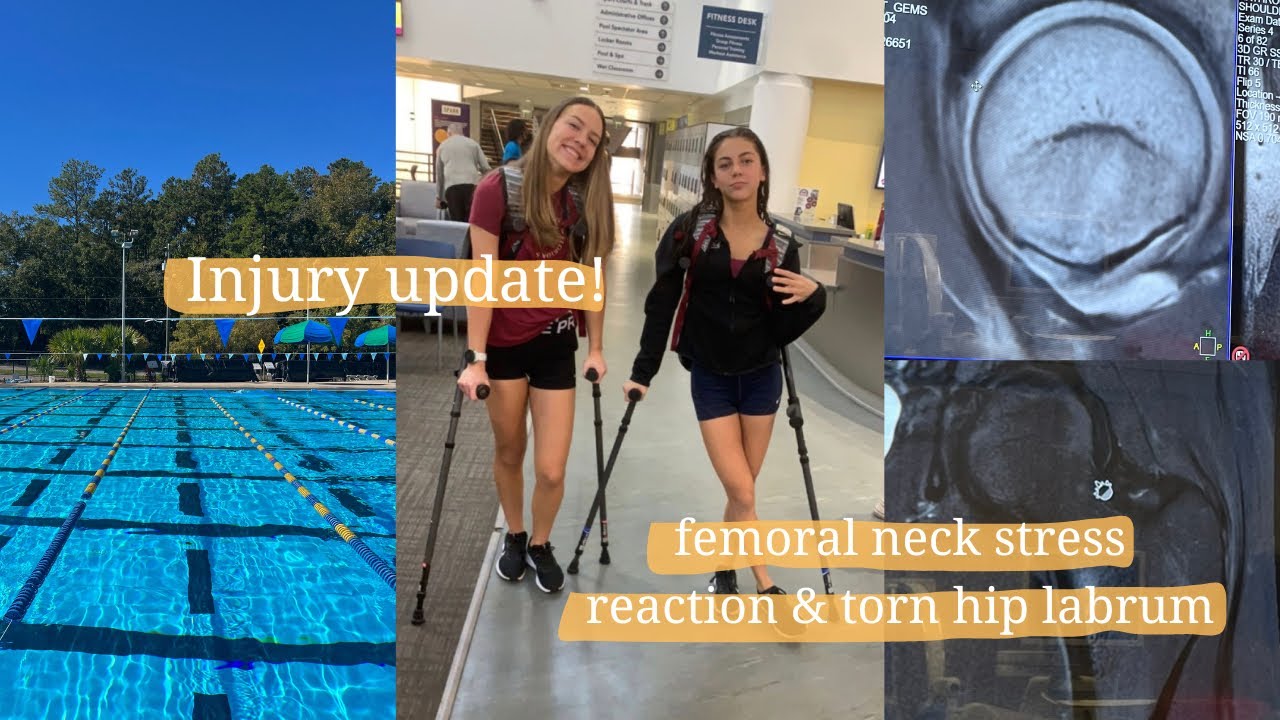 injury update! runner recovering from femoral neck stress reaction ...