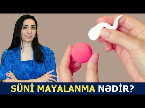SÜNİ MAYALANMA Necə Aparılır? | Ginekoloq Vüsalə Əzizova