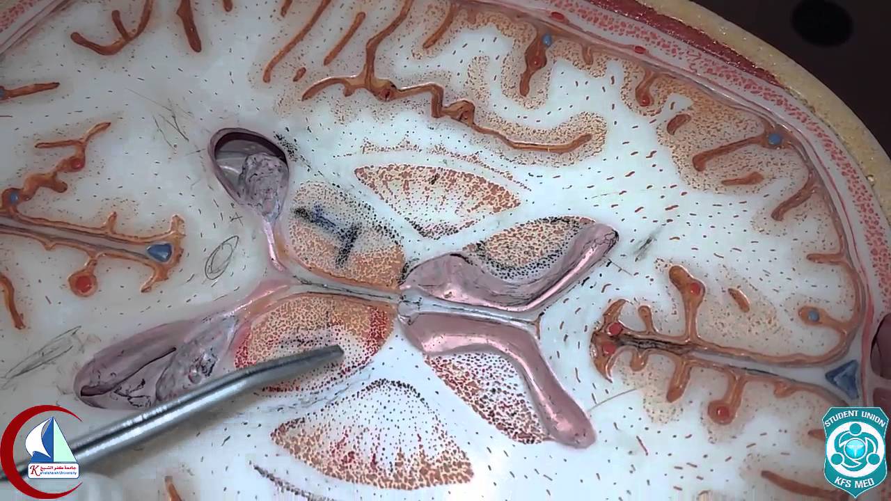 Brain horizontal sections | Practical anatomy 2nd year - YouTube