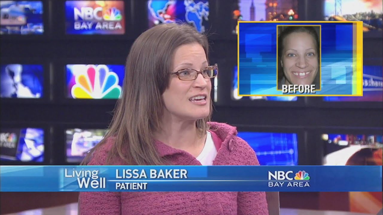Dr. Pannu discusses Dental Implants on NBC Bay Area's Living Well - YouTube