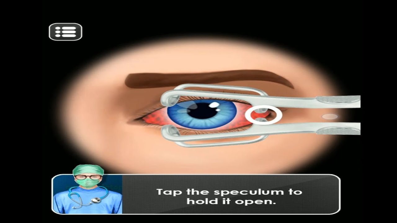 Retinal Detachment Repair Surgery Simulation Game - YouTube