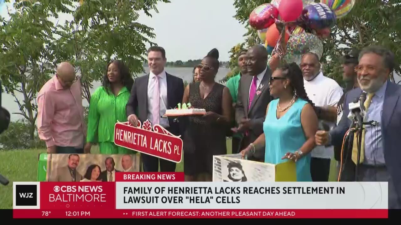 Family of Henrietta Lacks reaches settlement in lawsuit of "Hela" cells ...