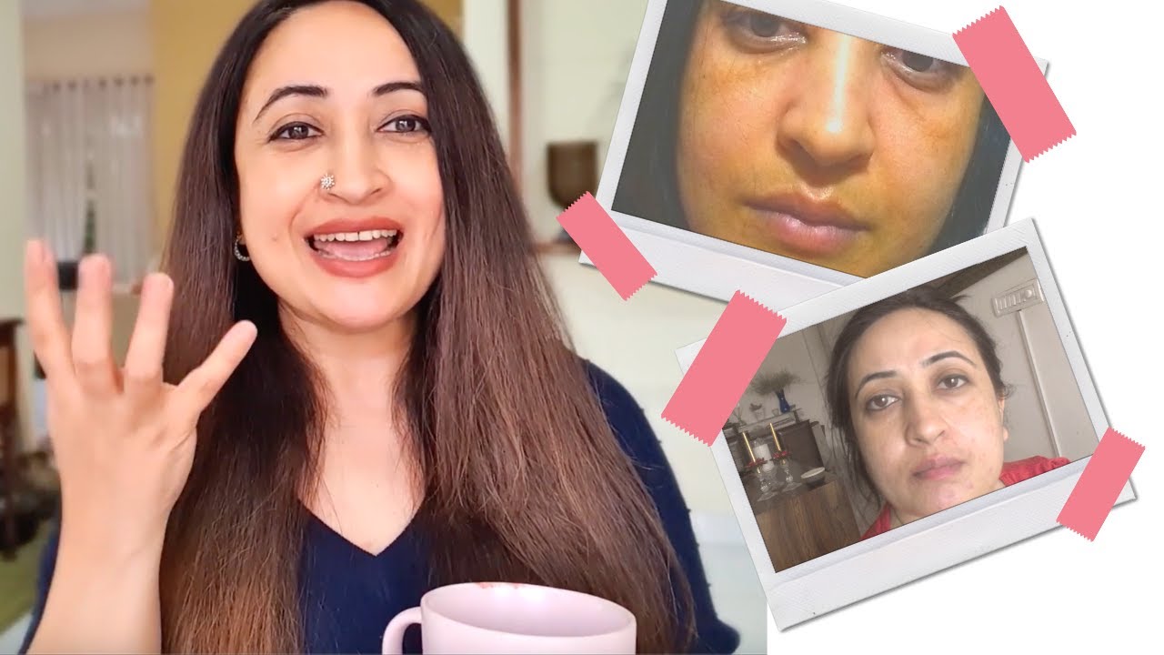 How To STOP HYPERPIGMENTATION On Face | Layering Guide ...