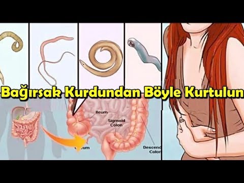 Bağırsak Kurduna Karşı Etkili Doğal Çözüm