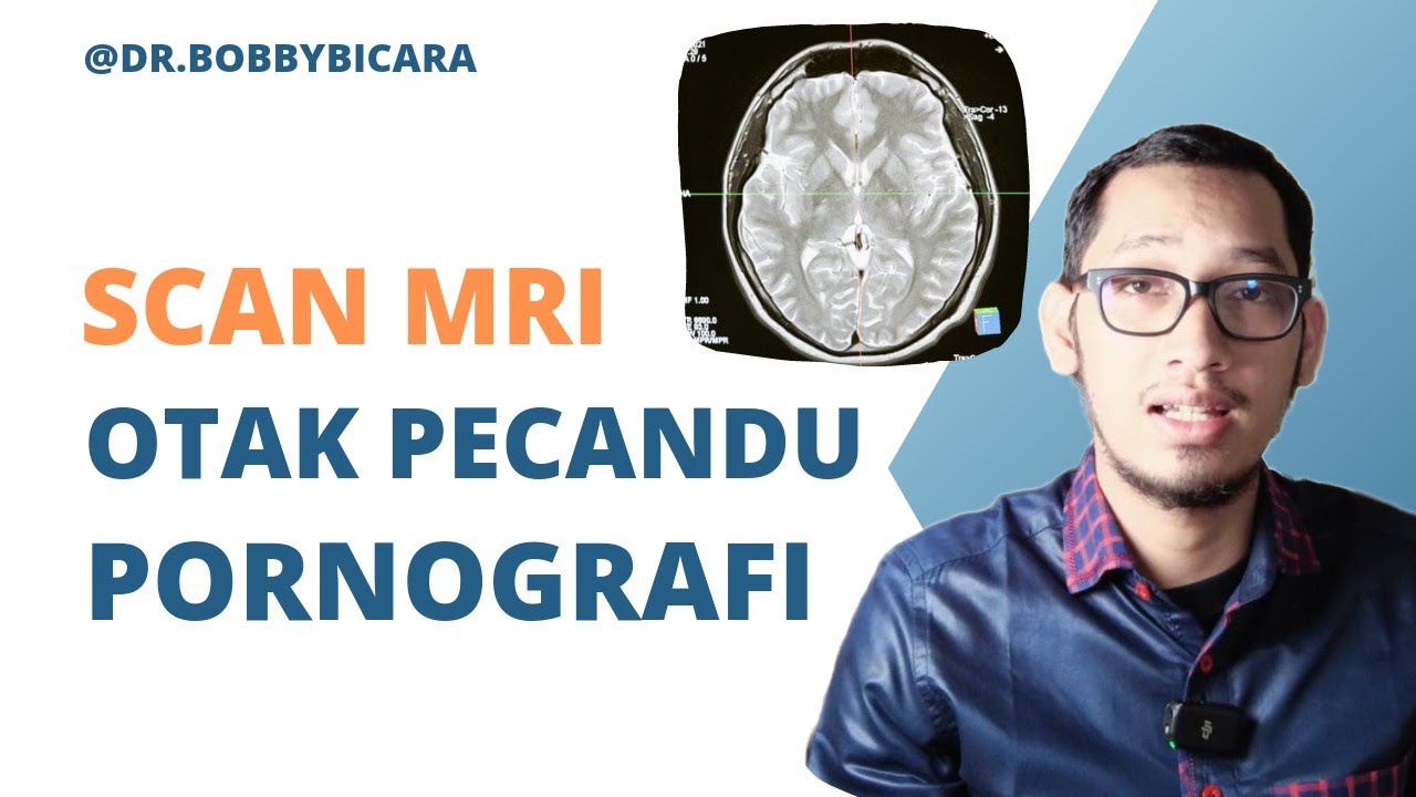 Perbandingan scan otak melalui pemeriksaan MRI pecandu pornografi dan ...