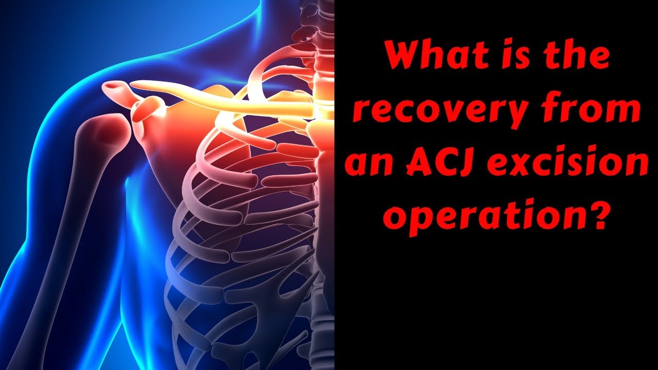 What is the recovery period like after ACJ excision surgery? - YouTube