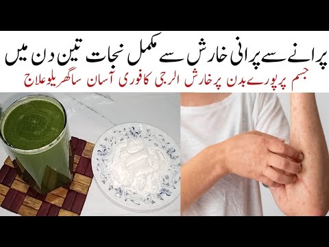 Kharish Itching Ka ilaj خارش کوجڑسےختم کرےفوری سکون اورآرام پہنچاۓ ...
