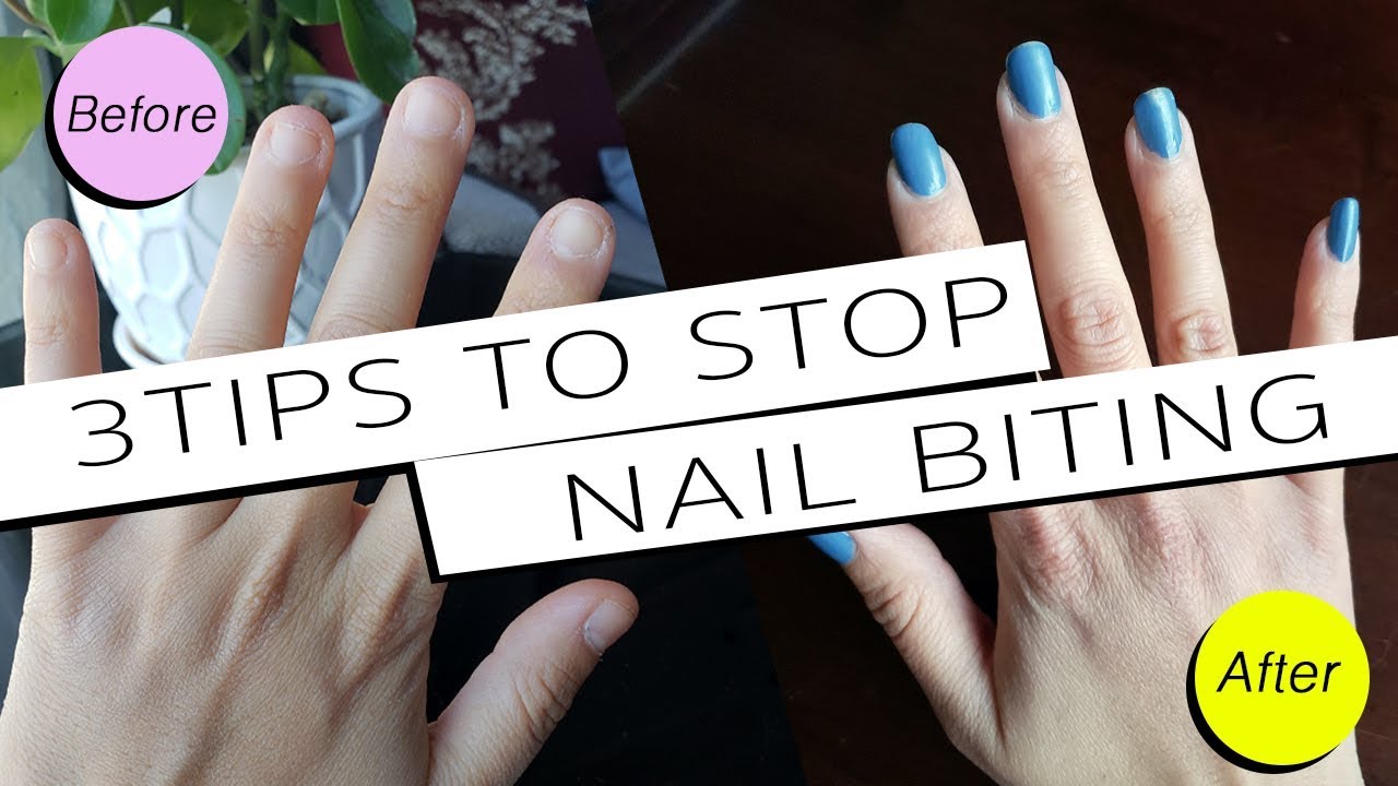 HOW TO STOP BITING YOUR NAILS 3 Fun Tips YouTube