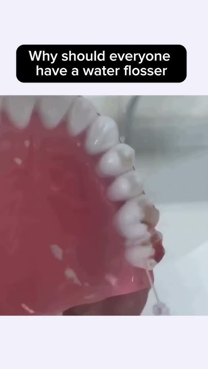 Top U.S. Dental Lab for advanced implant restorations & full-arch solutions! 🏆 - YouTube