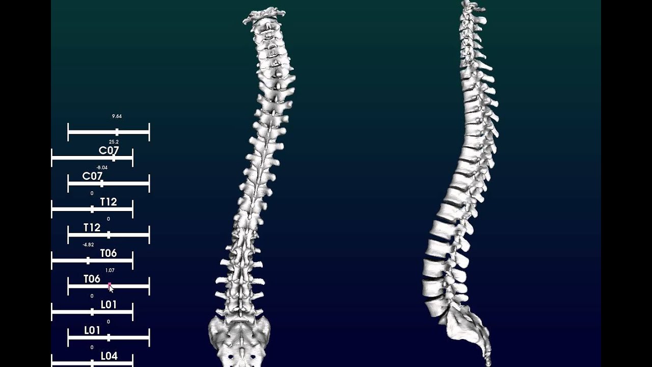 spine model demo v0.01 - YouTube