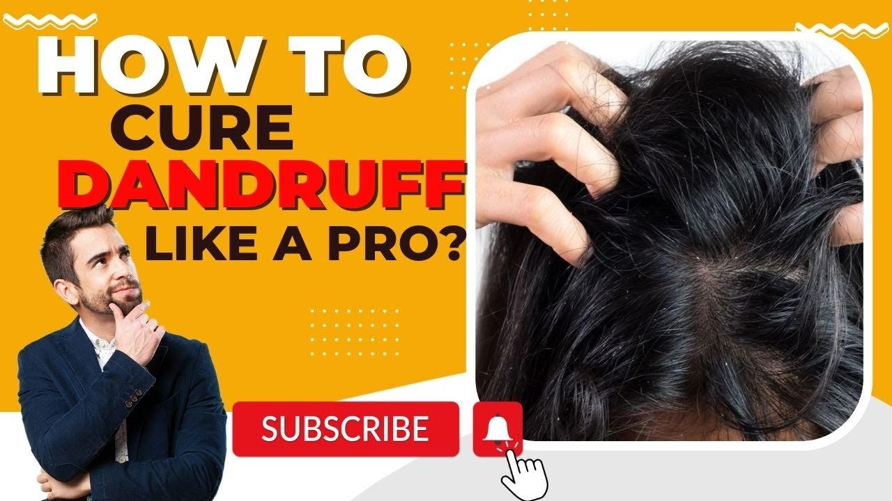 How To Cure Dandruff Like A Pro? - YouTube