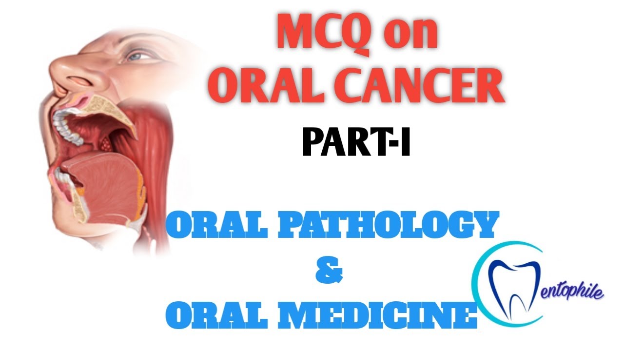 MCQs on Oral Cancer (Part I) || Oral Pathology & Medicine || Dentophile - YouTube