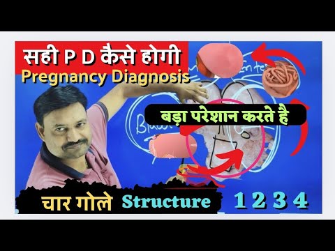 सही P D करने में बड़ा परेशान करते हैं 4 गोले 😱Pregnancy Diagnosis PD in ...