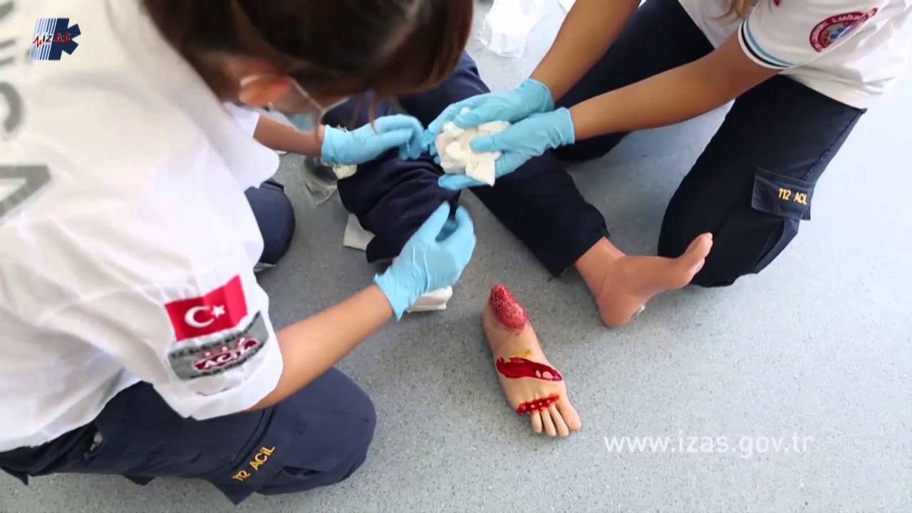 Ampute Organ Nakli - YouTube