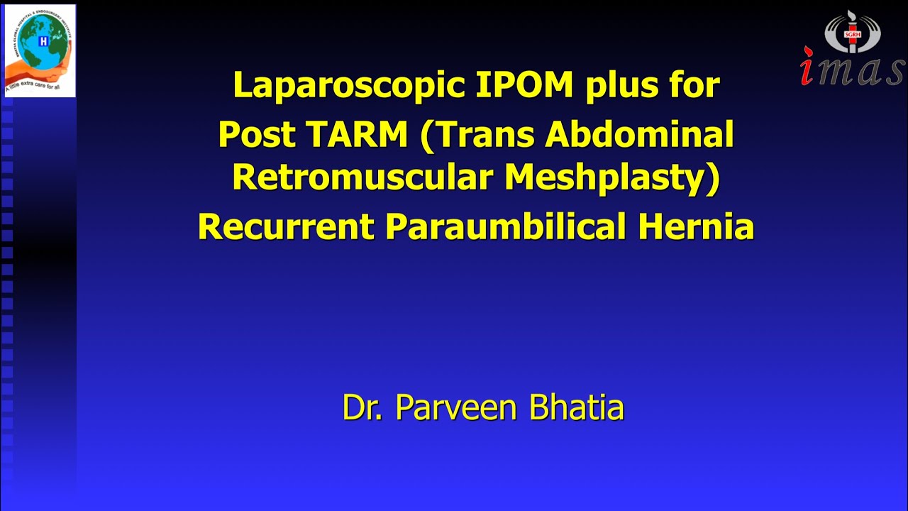 Laparoscopic IPOM plus for recurrent Supraumbilical hernia post TARM ...