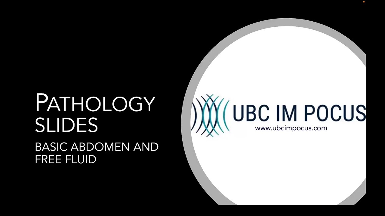 POCUS Pathology: Basic Abdomen and Free Fluid - YouTube