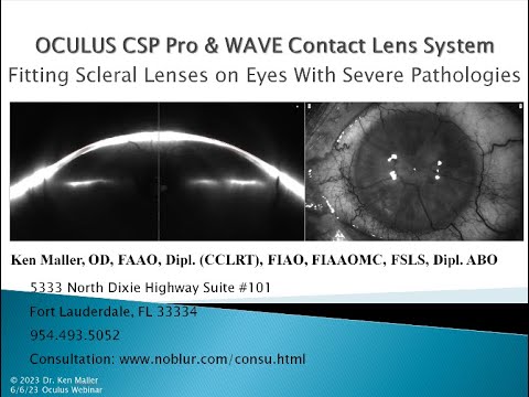 Dr. Ken Maller - OCULUS CSP Pro, WAVE Contacts, Scleral Lenses on ...
