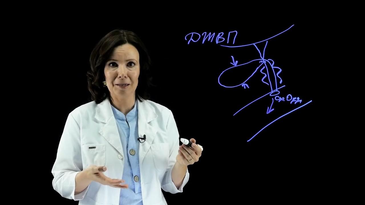 Дискинезия желчевыводящих путей (ДЖВП). Что это такое? - YouTube