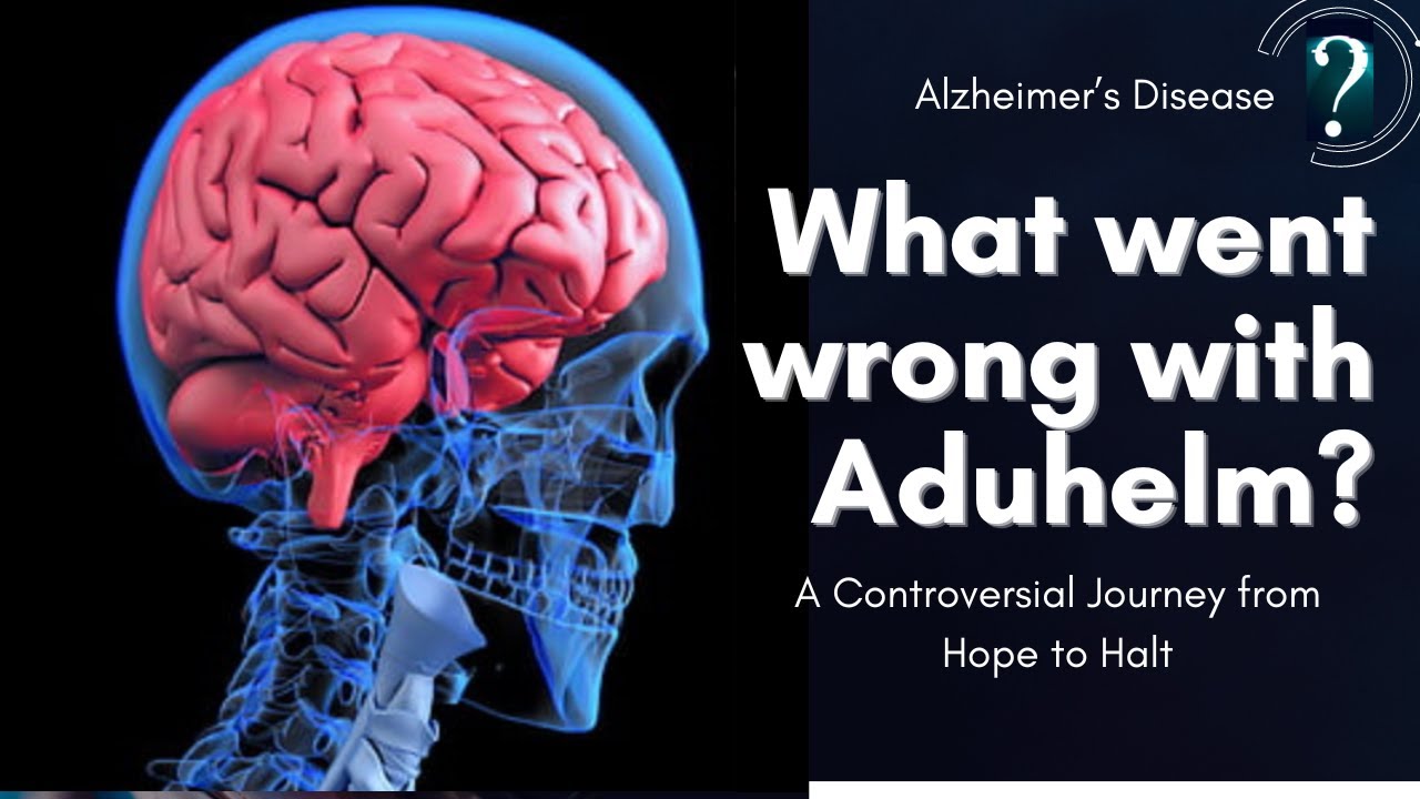 Aduhelm: A Controversial Journey from Hope to Halt - YouTube