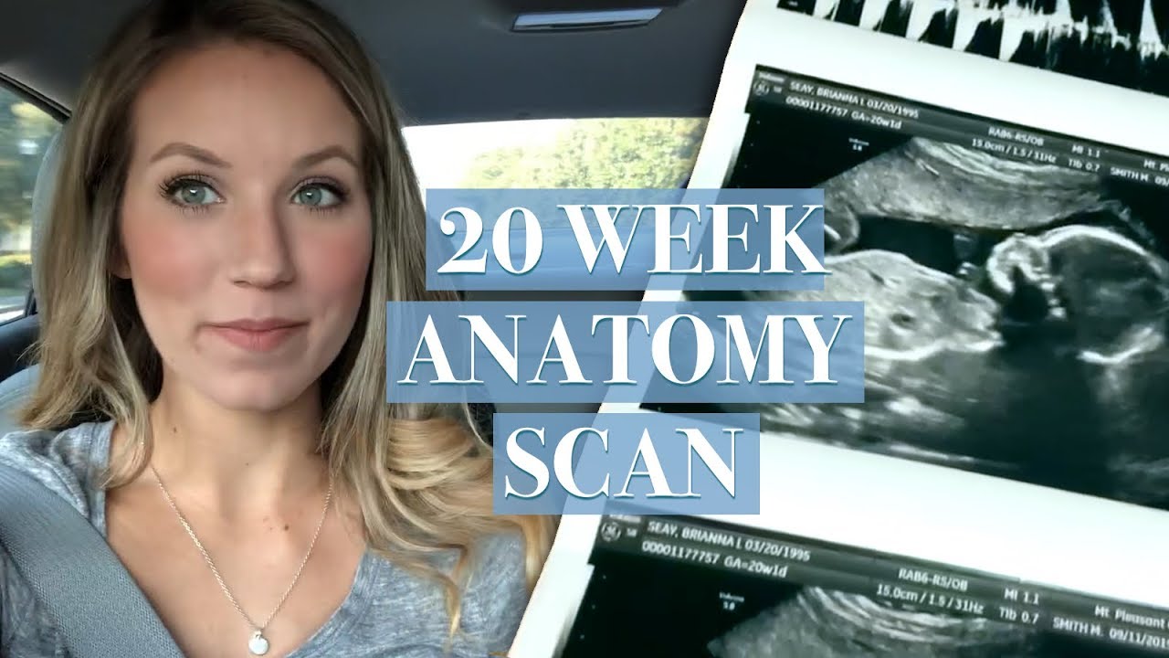20 Week Ultrasound | Anatomy Scan - YouTube