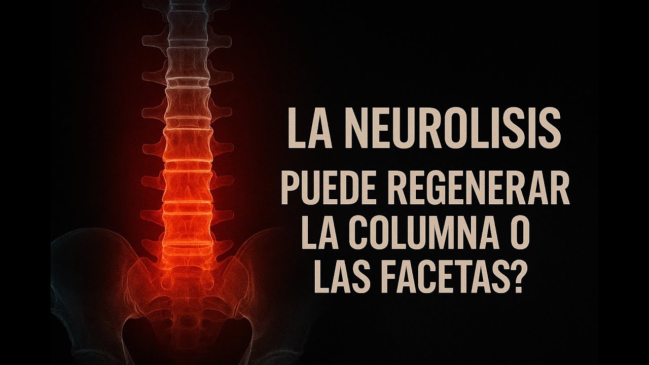 La neurolisis ¿Puede regenerar la columna o las facetas? - YouTube