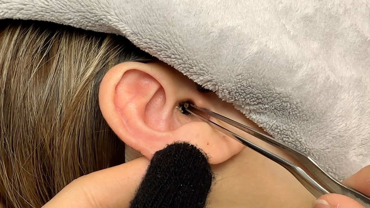 ASMR Ear Cleaning | Ultimate Satisfying Earwax Removal | No Talking ...