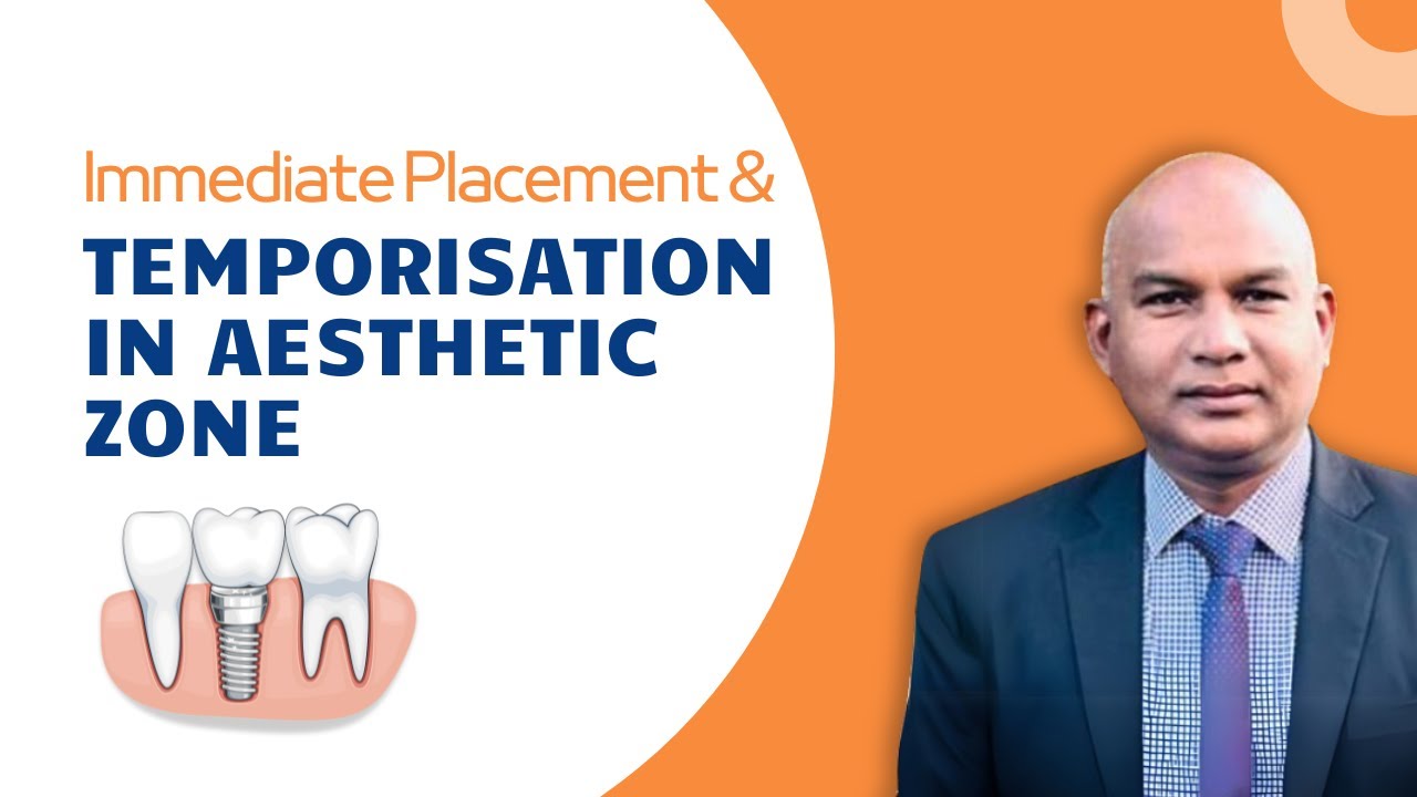 Implant Placement & Temporization in the Aesthetic Zone | Dr. V ...