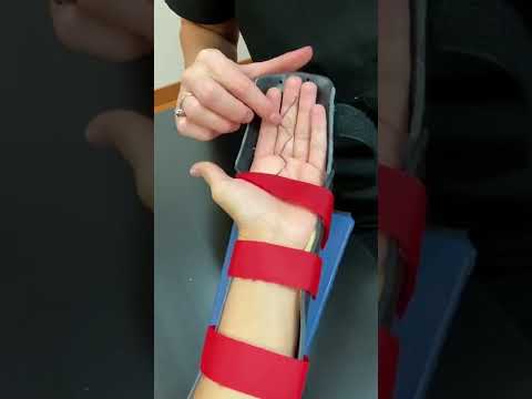 St. John's Protocol - Flexor Tendon Injury - YouTube