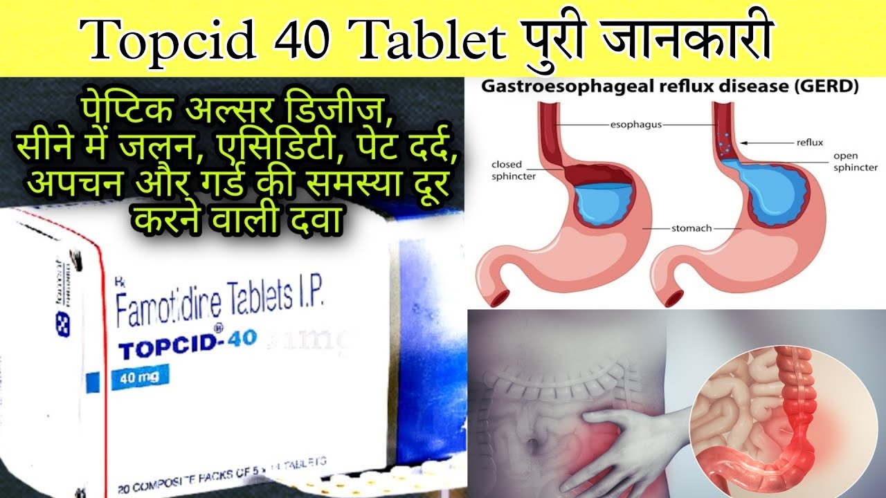 Topcid 40 Tablet | Famotidine Tablet | Uses | Dose | Side effects ...
