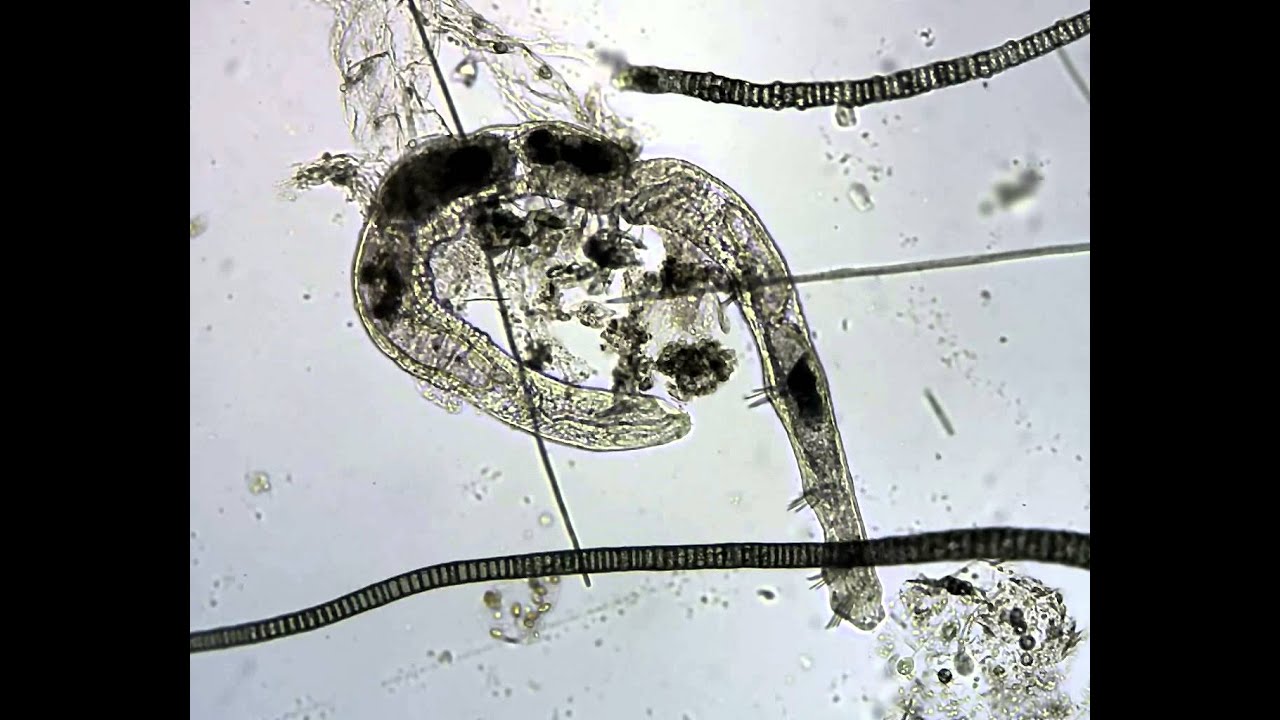 Chaetogaster sp. (HD) - YouTube