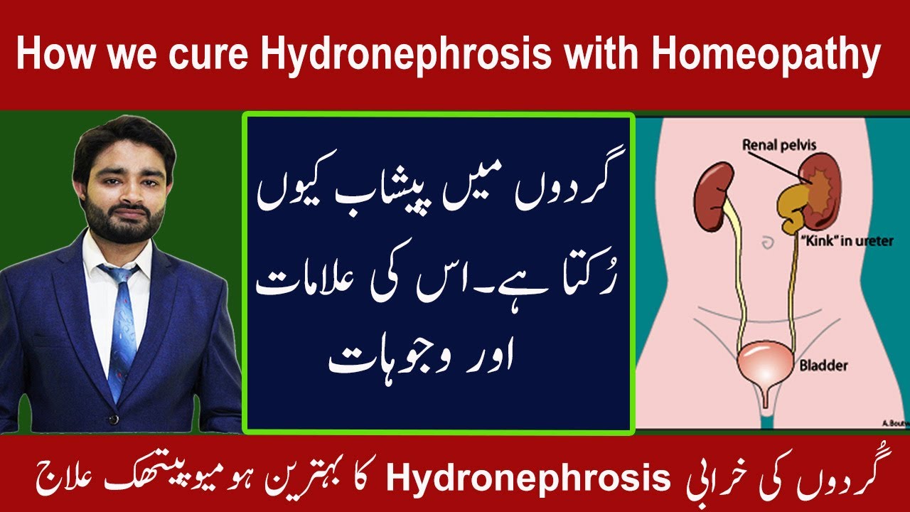 Hydronephrosis best homeopathic treatment | homeopathic medicine ...