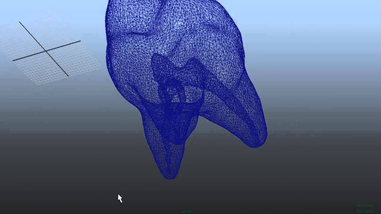 3D Printed tooth - YouTube