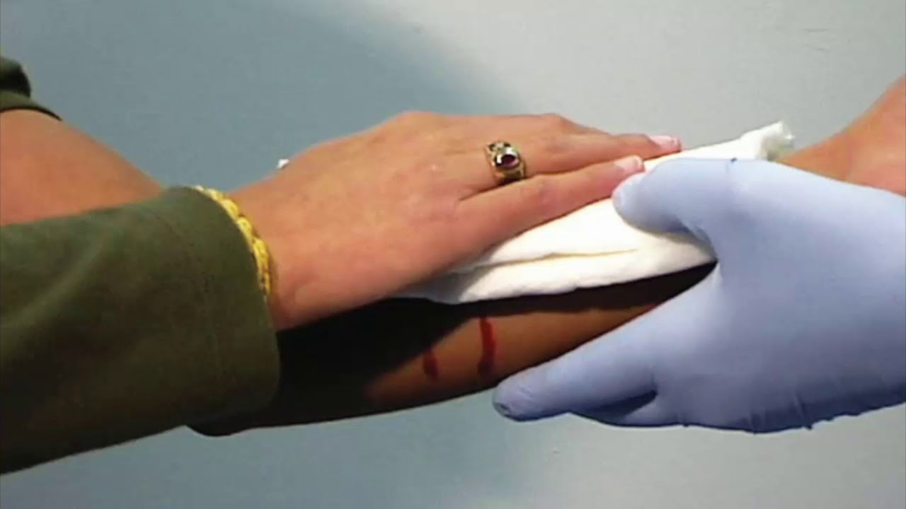 First Aid During Monkey Bite || Information - YouTube