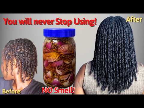 My hair can't stop growing, Make Onion juice this way to Double Hair Growth & stop hair loss