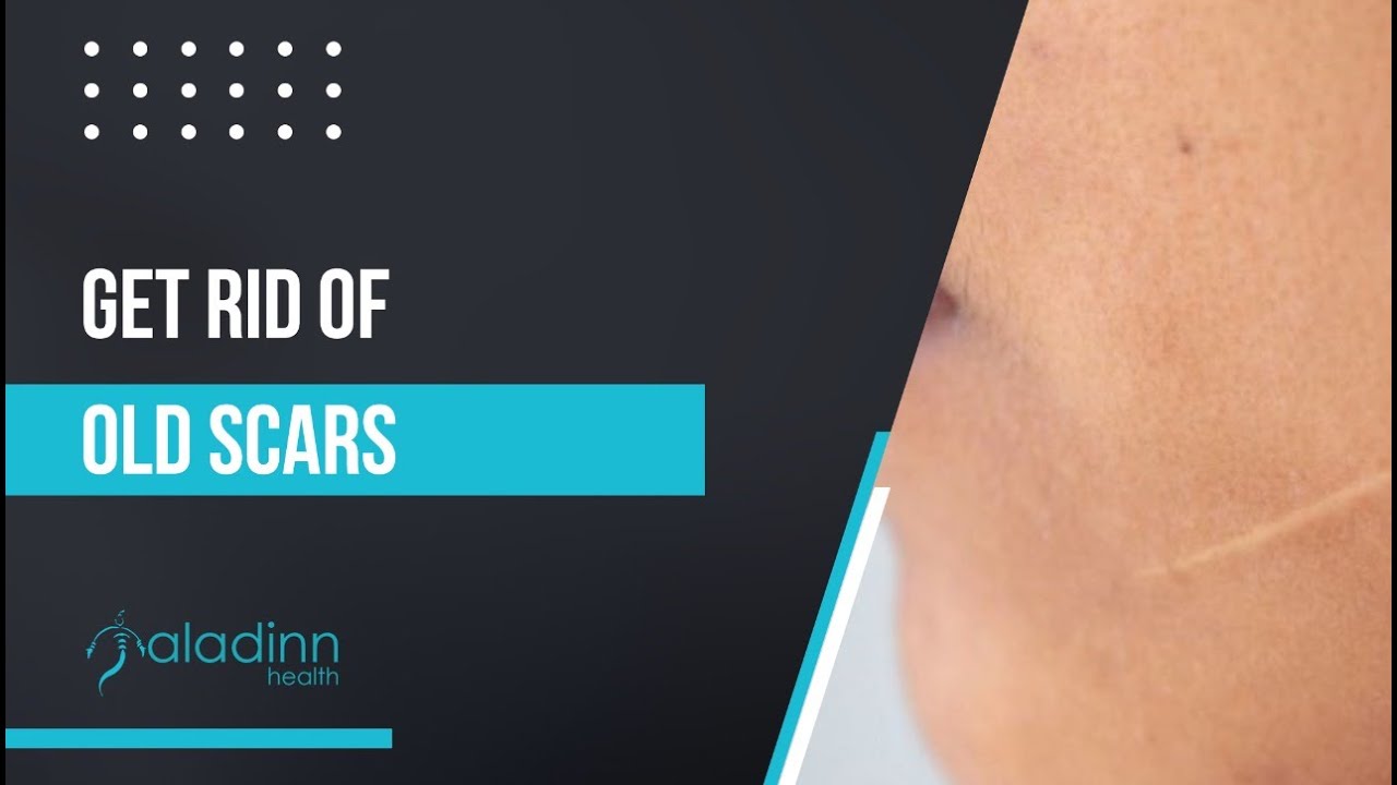 Scar Treatments | How Do You Get Rid Of Old Scars? - YouTube