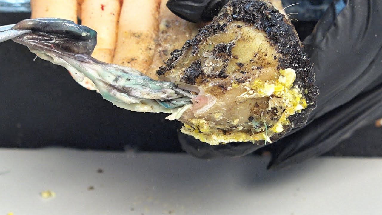 CUT Ingrown Toenails 👣 Toenails with Maggots, Fungal Toenails ...